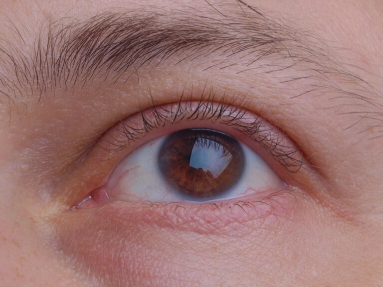 Blue Ring Around Eyes Spiritual Meaning